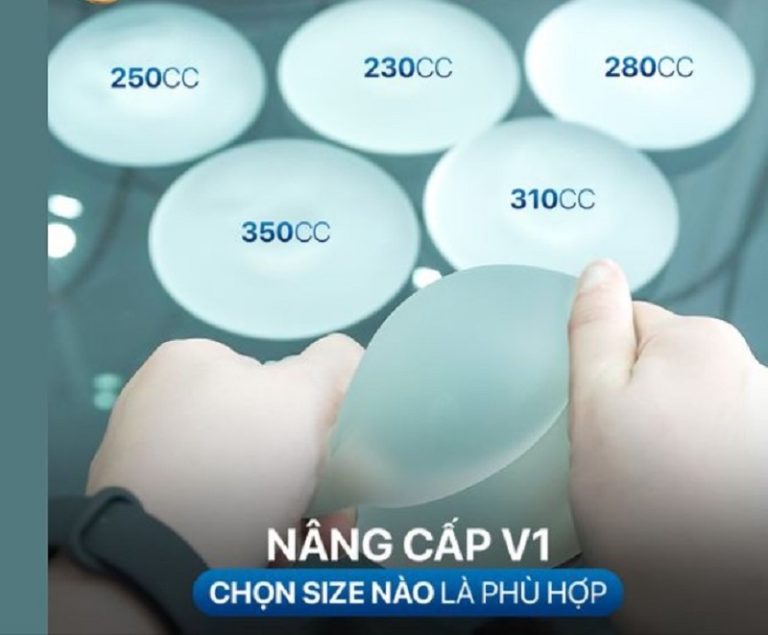 Túi Mentor Xtra có các size nào? tips chọn size túi ngực