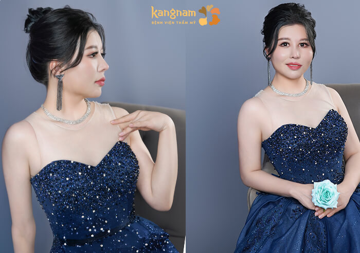 TS.BS Richard Huy trải lòng về ca chỉnh hình di chứng sau liệt dây thần ...