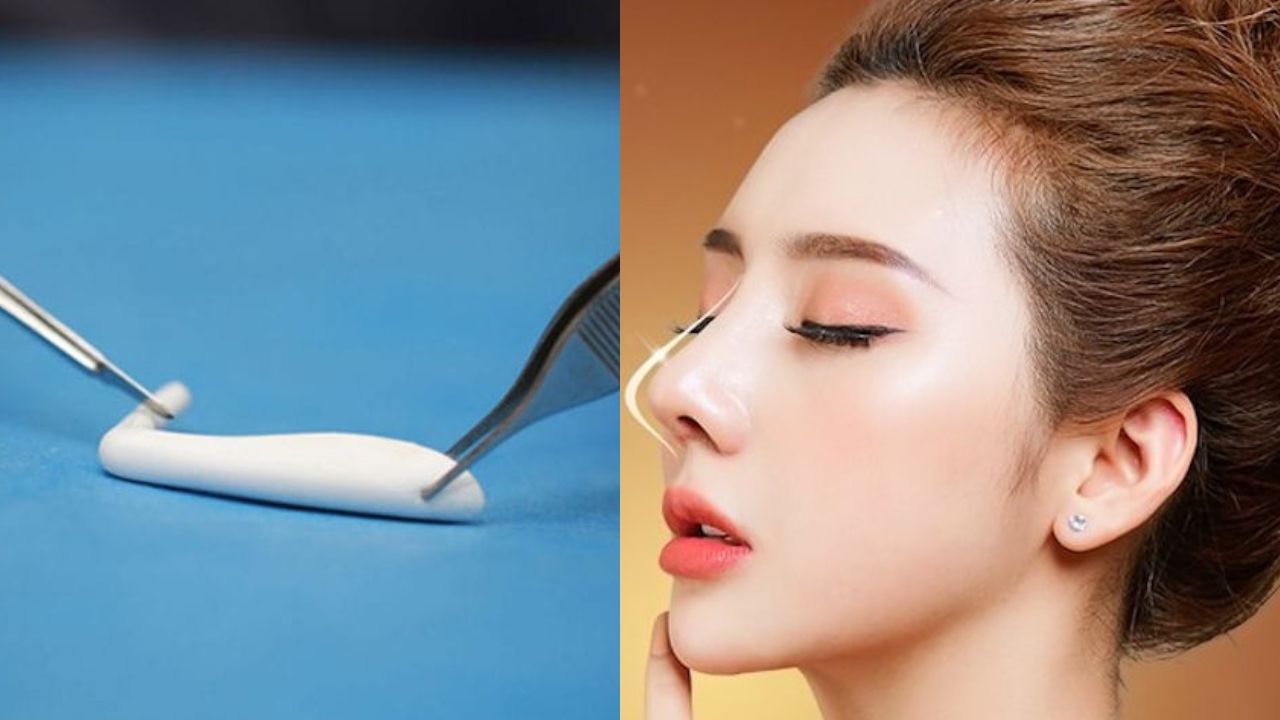 Sụn nâng mũi dùng được bao lâu? Review độ bền thực tế và 3 yếu tố giúp ...